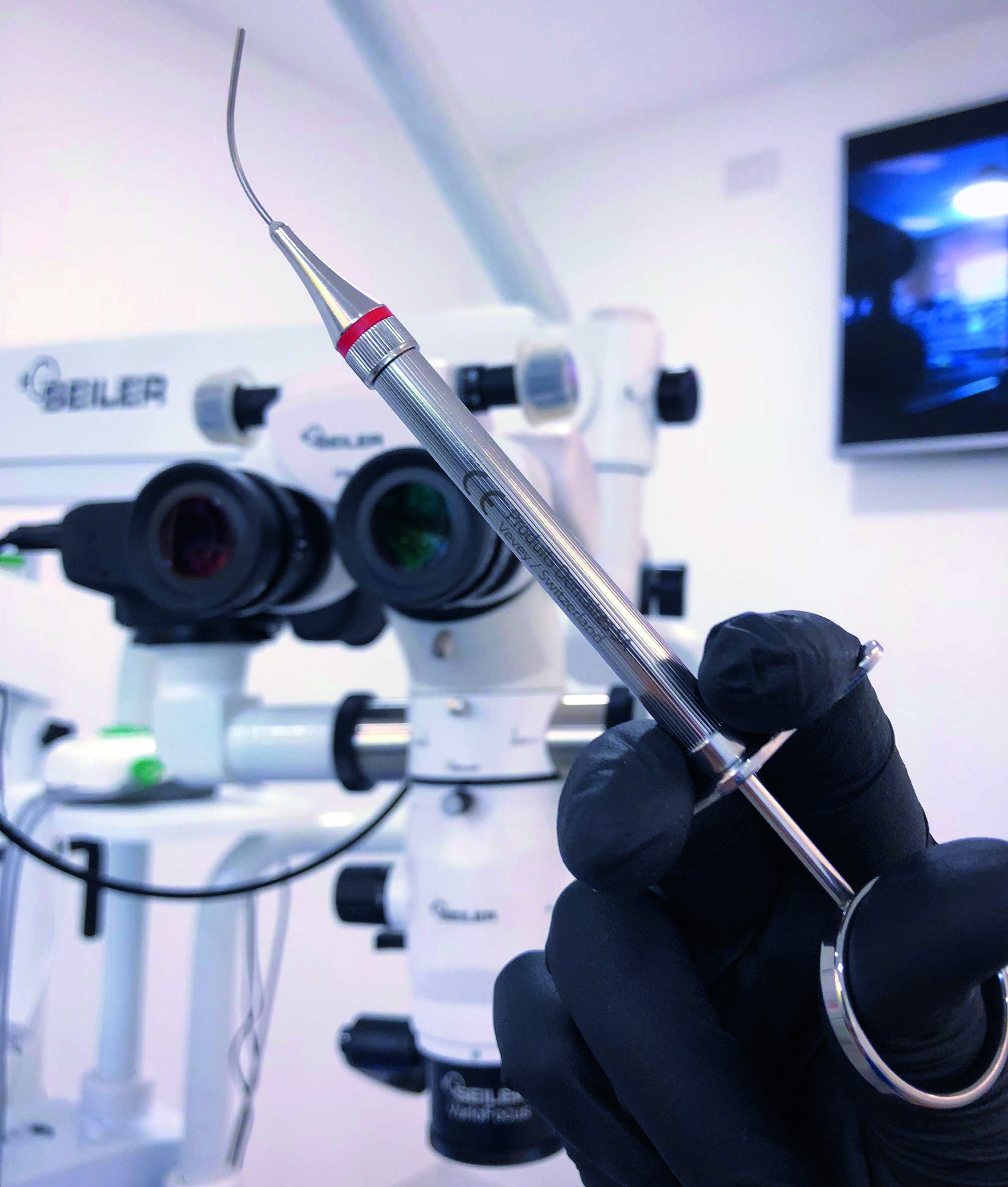 Dental News - Direct pulp capping as a conservative procedure to ...