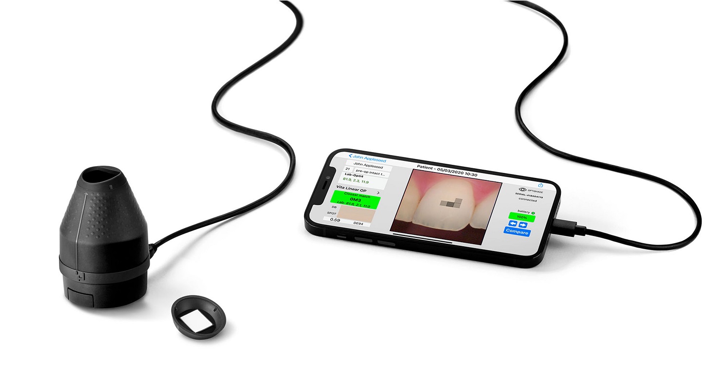 Digital dental shade measurement