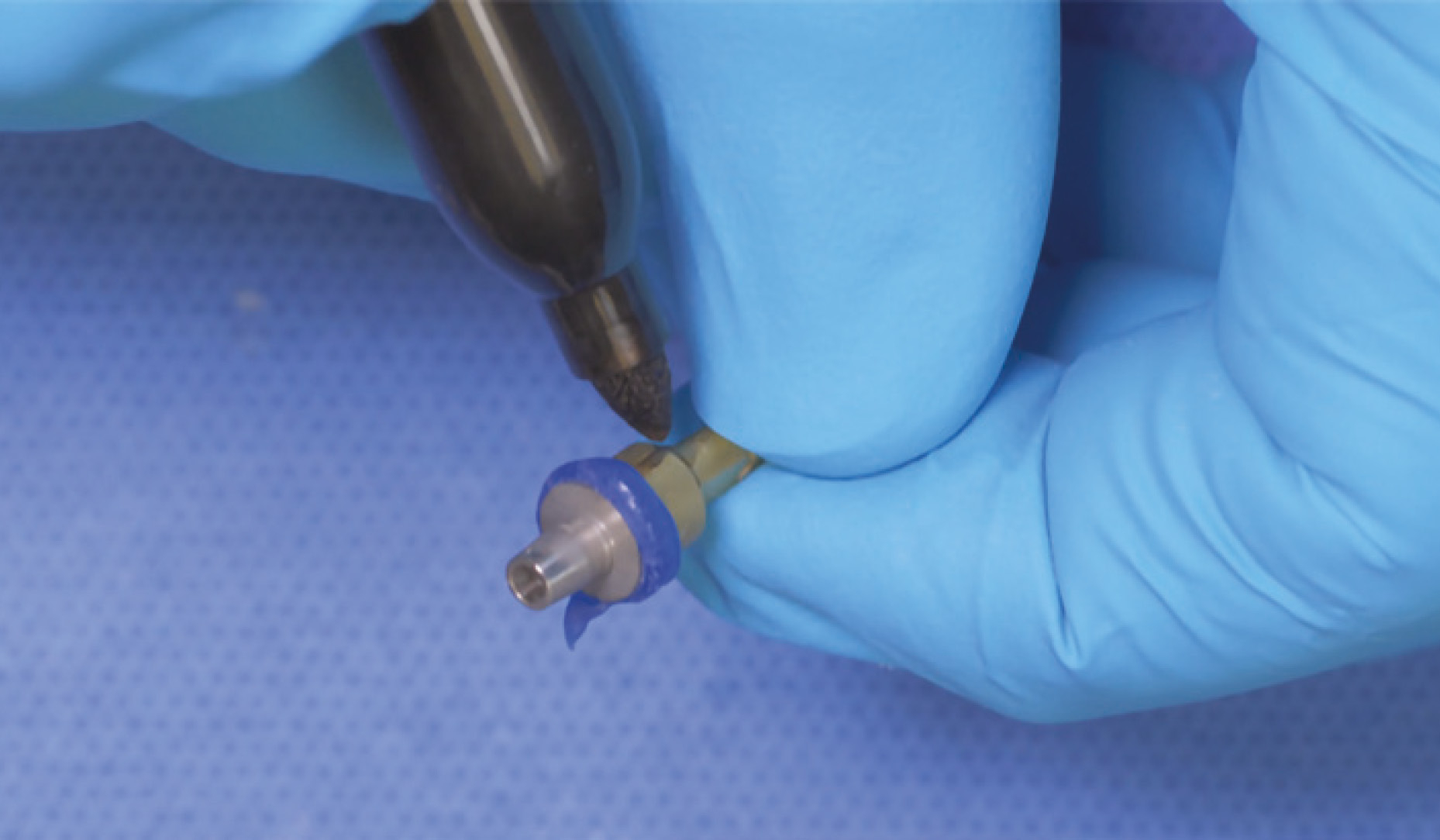 Titanium base implant cementation technique